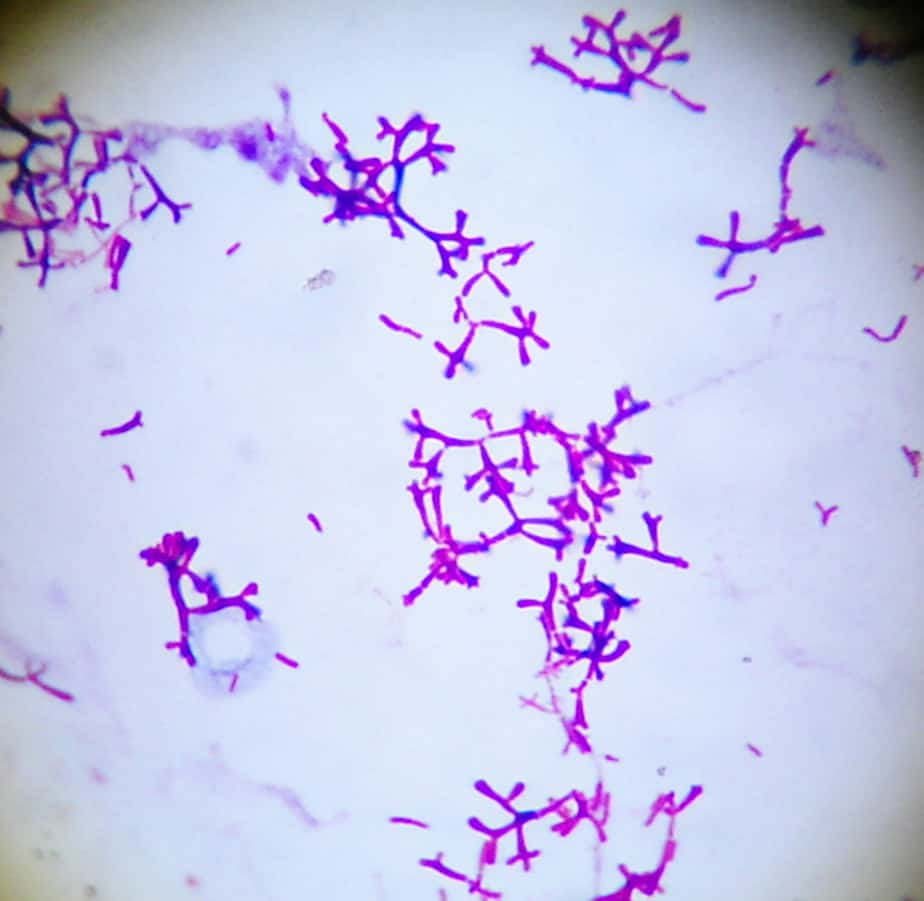 Bifidobacterium lactis - JCM 10602