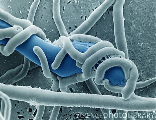 Trichoderma asperellum - NBRC 101777