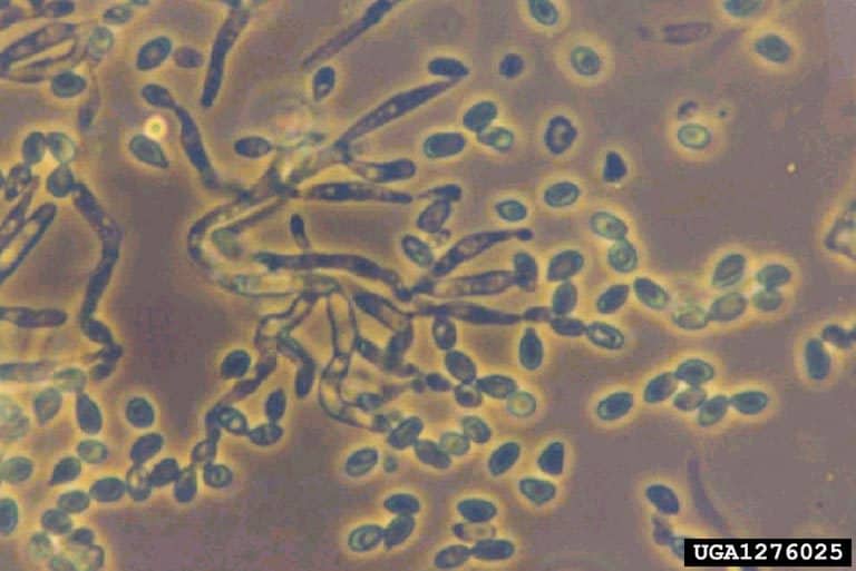 Metarhizium - CHỦNG VI SINH VẬT CHUẨN ATCC