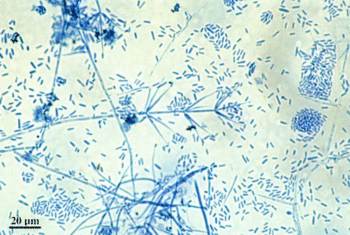 Verticillium lecanii - NBRC 8579