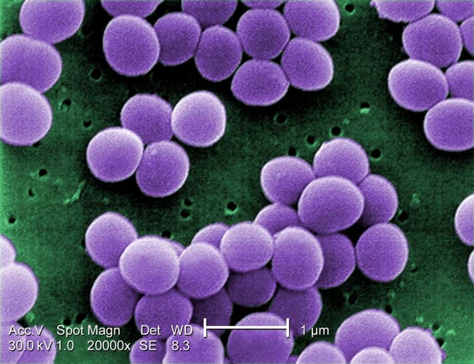 Staphylococcus aureus - NBRC 100910