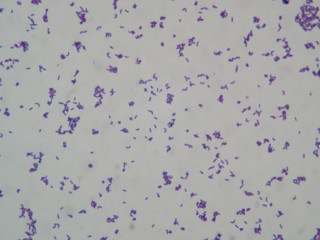 Arthrobacter globiformis - NBRC 12137