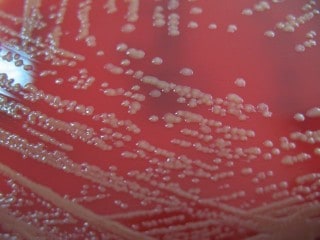 Pantoea agglomerans - NBRC 102470