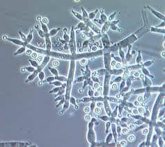 Trichoderma - CHỦNG VI SINH VẬT CHUẨN ATCC