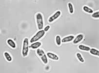 Saccharomyces - CHỦNG VI SINH VẬT CHUẨN ATCC