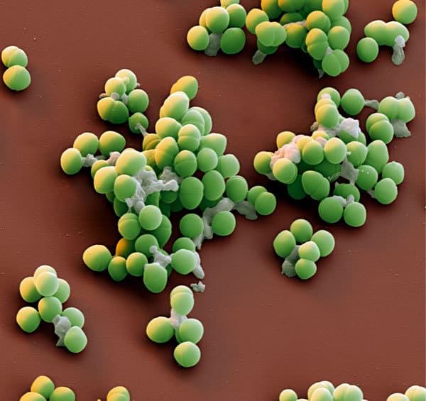 Enterococcus Hirae