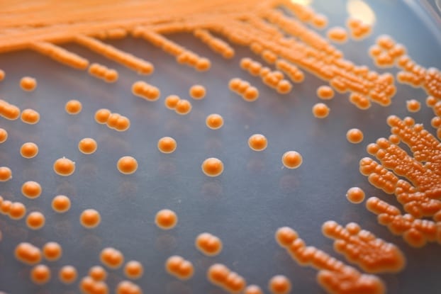 Xanthophyllomyces dendrorhous - NBRC 10129 - Industrial Production of ...