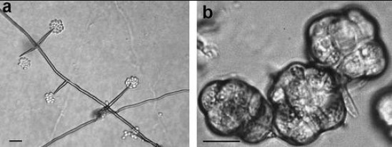 Pochonia chlamydosporia - NBRC 9249 - CHỦNG VI SINH VẬT CHUẨN ATCC